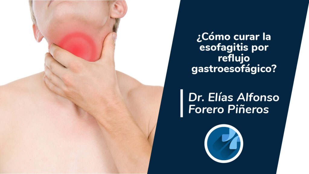 ¿Cómo curar la esofagitis por reflujo gastroesofágico? – Dr. Elías Forero.