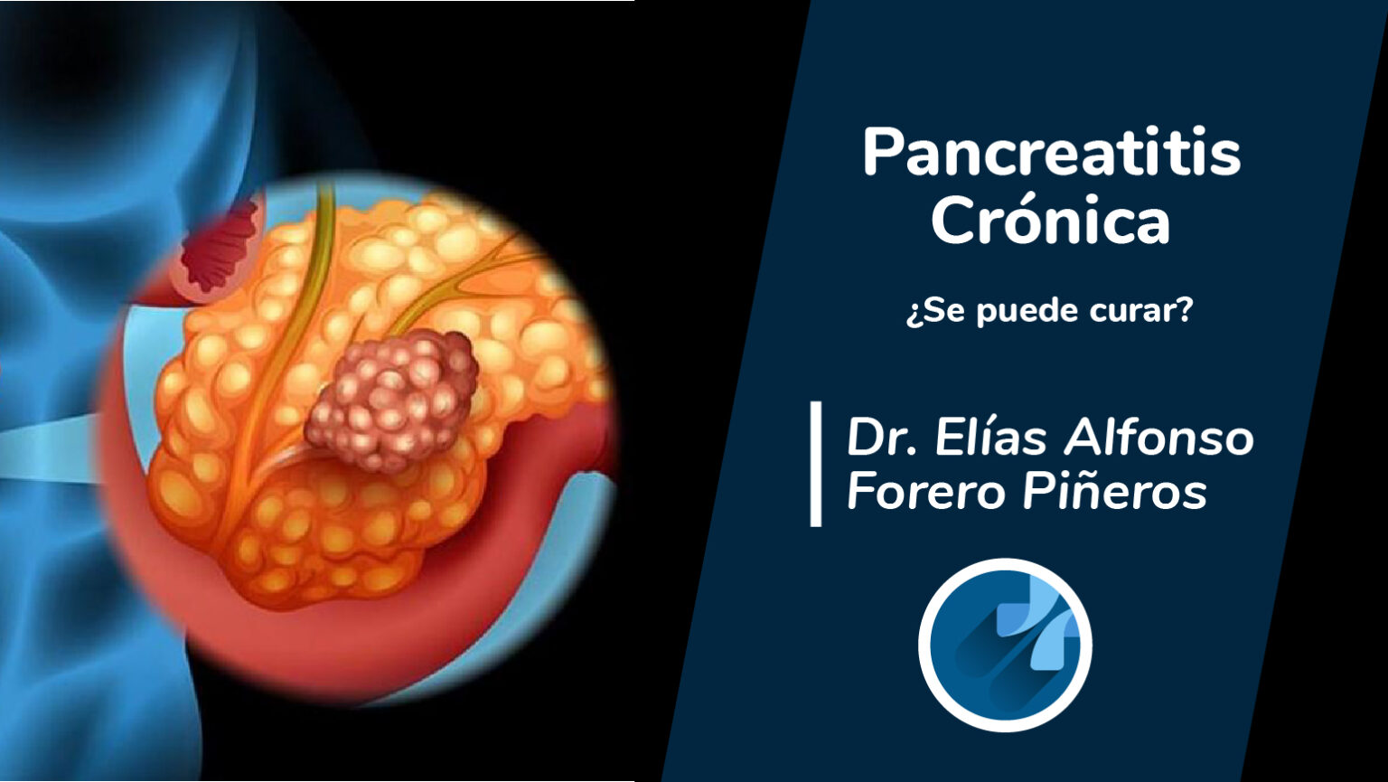 Pancreatitis crónica: ¿Se puede curar? | Dr. Elías Alfonso Forero
