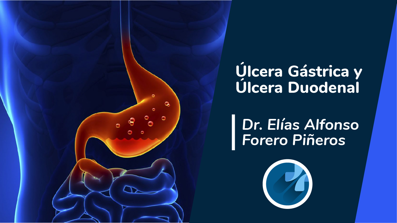 Úlcera Gástrica y Úlcera Duodenal: ¿Cómo tratarla? | Dr. Elías Forero.